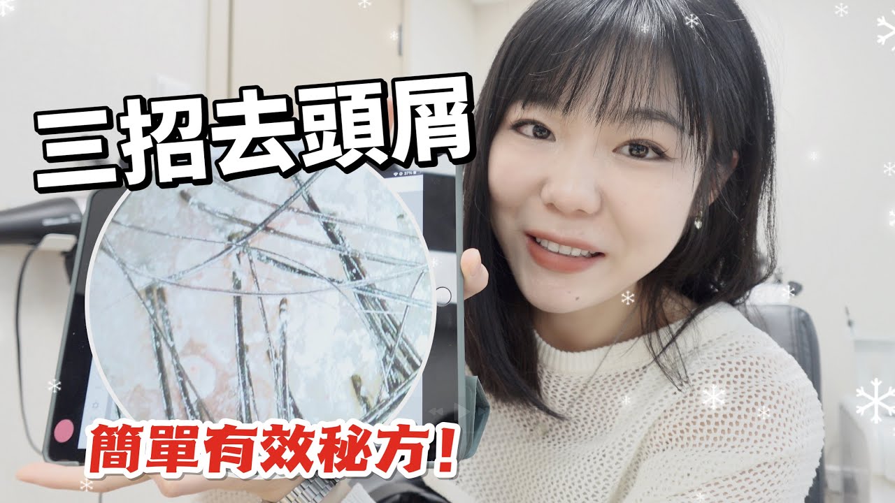 【了解頭皮】頭癢！頭皮屑！頭皮發炎！超有效又簡單的秘訣，由根源解決 ️ ｜Lowang 🦌 - PressMega